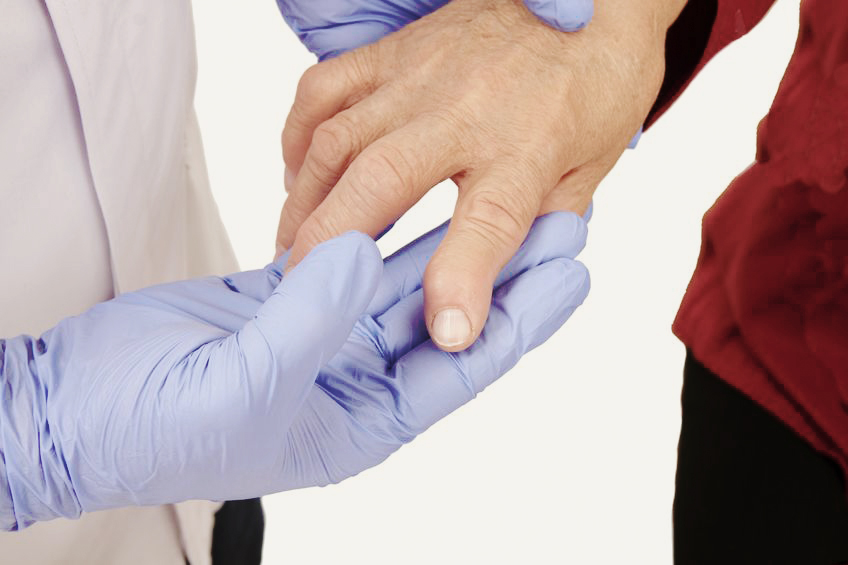 Waar de reumatoloog en handtherapeut elkaar ontmoeten | Inflammatoire reuma